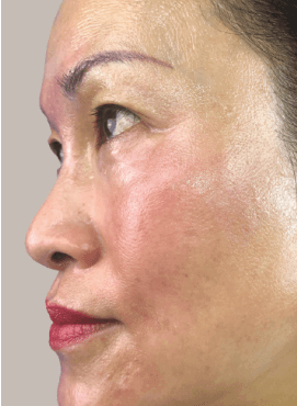 The Musely Story | Musely Reviews | Musely FaceRx