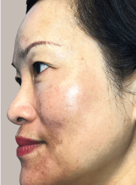 The Musely Story | Musely Reviews | Musely FaceRx