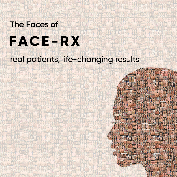 Real Life-Changing Results With Musely FaceRx | #MuselyWorks