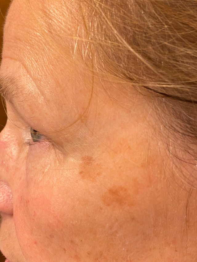 Musely Prescription Skin Care Products | Dark Spots, Aging, Rosacea ...