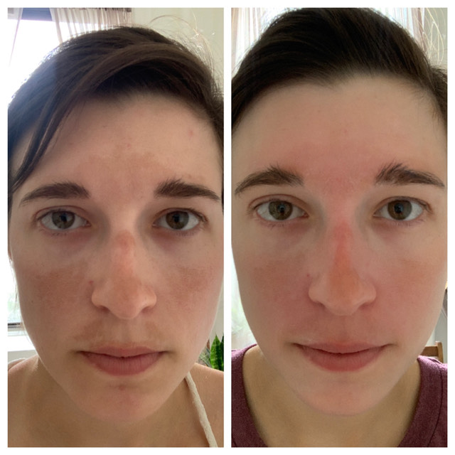 Real Life-Changing Results With Musely FaceRx | #MuselyWorks