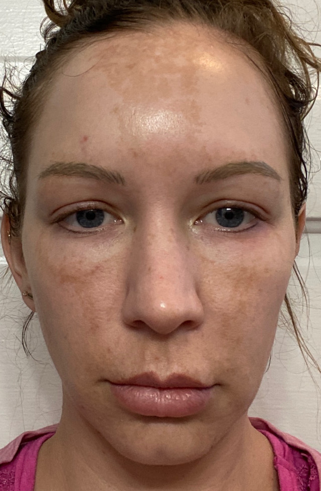 Musely FaceRx: Prescription Skincare Beauty Products