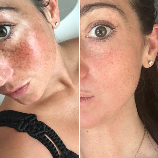 Musely FaceRx: Prescription Skincare Beauty Products