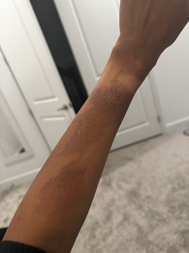 Musely Prescription Skin Care Products | Dark Spots, Aging, Rosacea ...