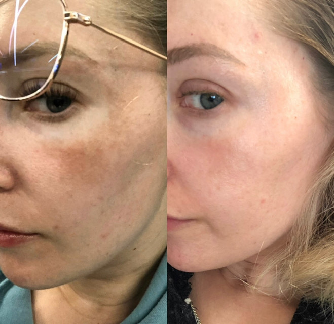Real Life-Changing Results With Musely FaceRx | #MuselyWorks