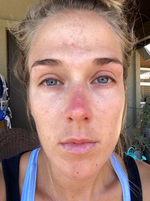 Musely Prescription Skin Care Products | Dark Spots, Aging, Rosacea ...