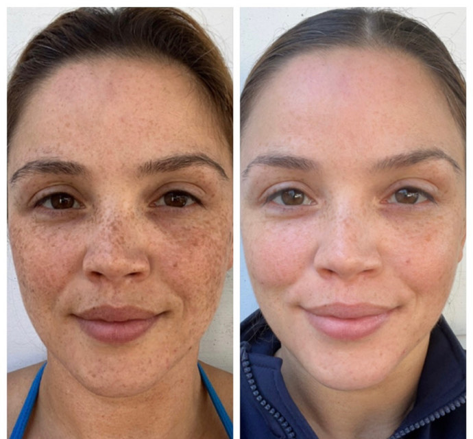 Real Life-Changing Results With Musely FaceRx | #MuselyWorks