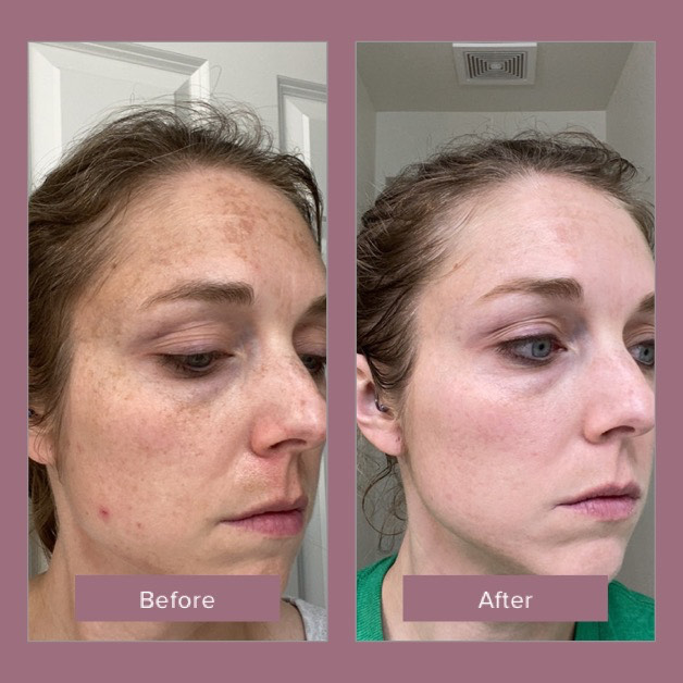 Musely FaceRx: Prescription Skincare Beauty Products