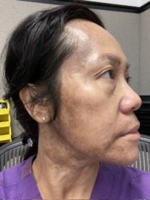 Rosacea Treatment | Facial Hair Removal | Anti-Aging Cream | Musely