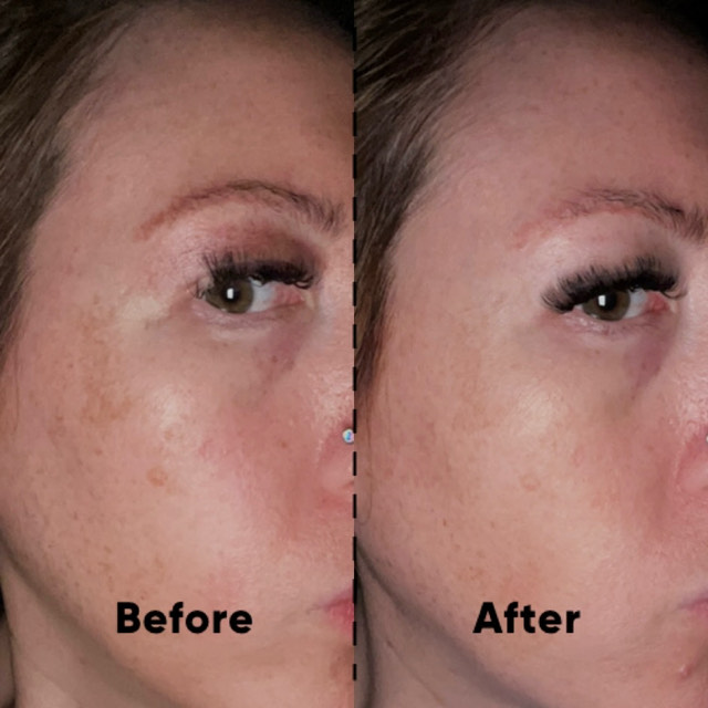 Musely FaceRx: Prescription Skincare Beauty Products