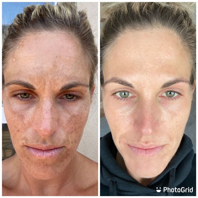 Musely FaceRx: Prescription Skincare Beauty Products