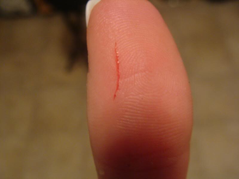 Paper Cut Injury