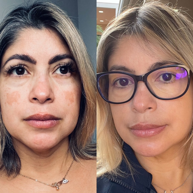 Musely FaceRx: Prescription Skincare Beauty Products