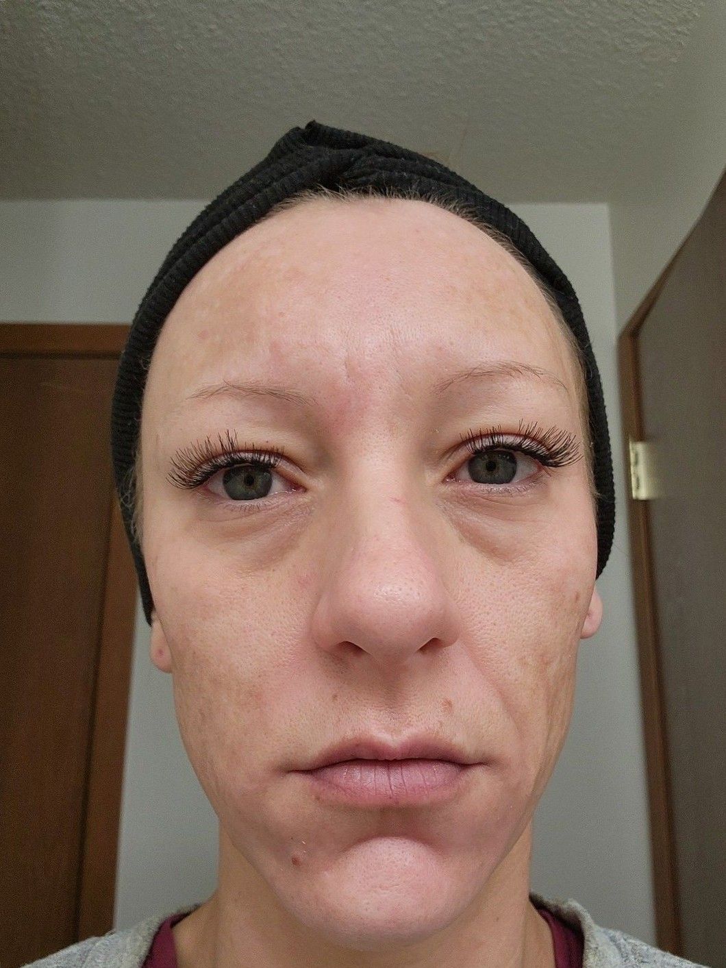 Musely FaceRx: Prescription Skincare Beauty Products