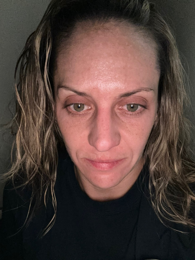 Real Results And Testimonials | Musely FaceRx Community