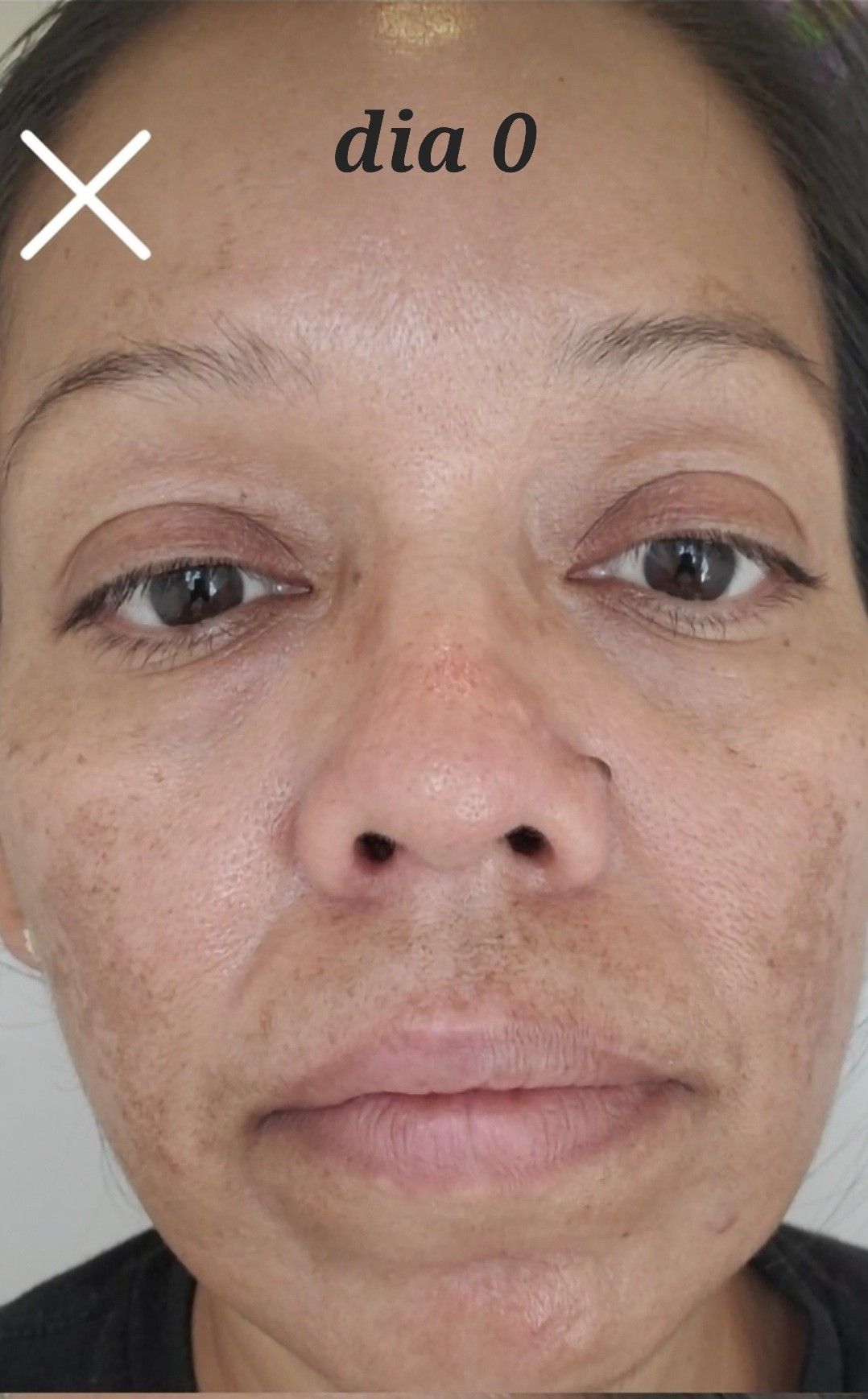 Musely FaceRx: Prescription Skincare Beauty Products