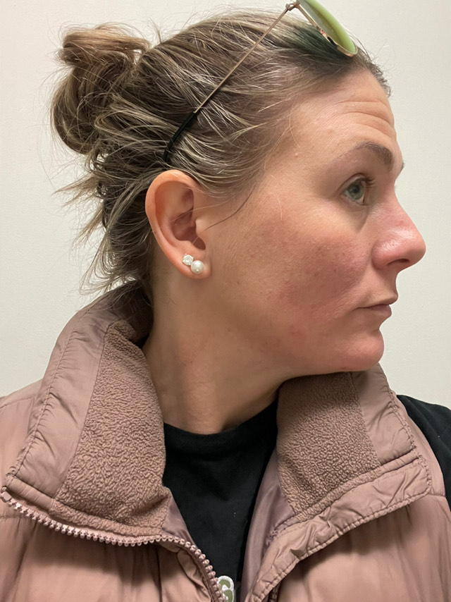 Real Results And Testimonials | Musely FaceRx Community