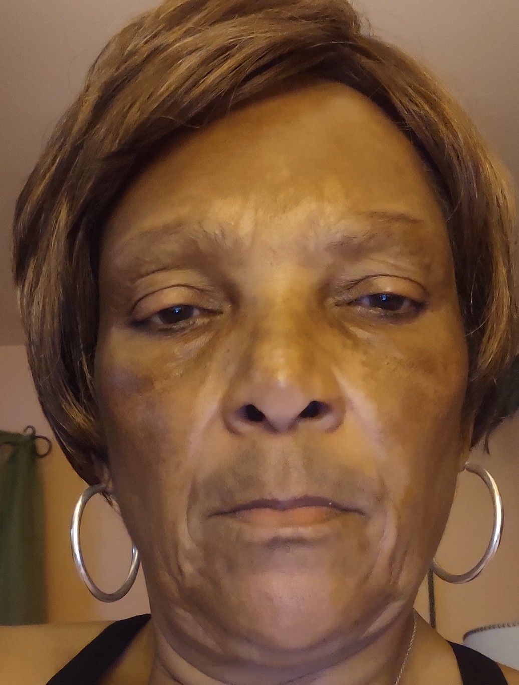 Musely Prescription Skin Care Products | Dark Spots, Aging, Rosacea ...