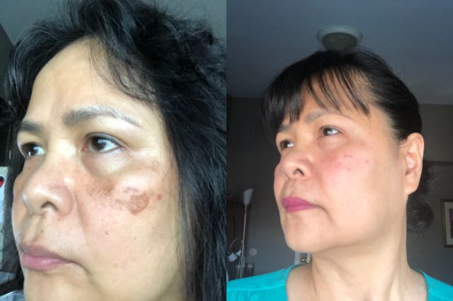 Real Life-Changing Results With Musely FaceRx | #MuselyWorks