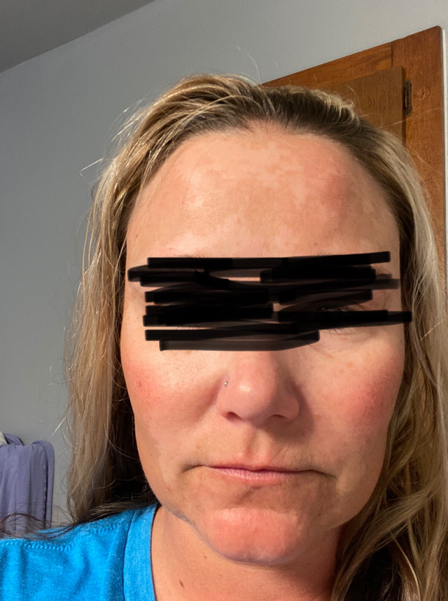 Musely FaceRx: Prescription Skincare Beauty Products