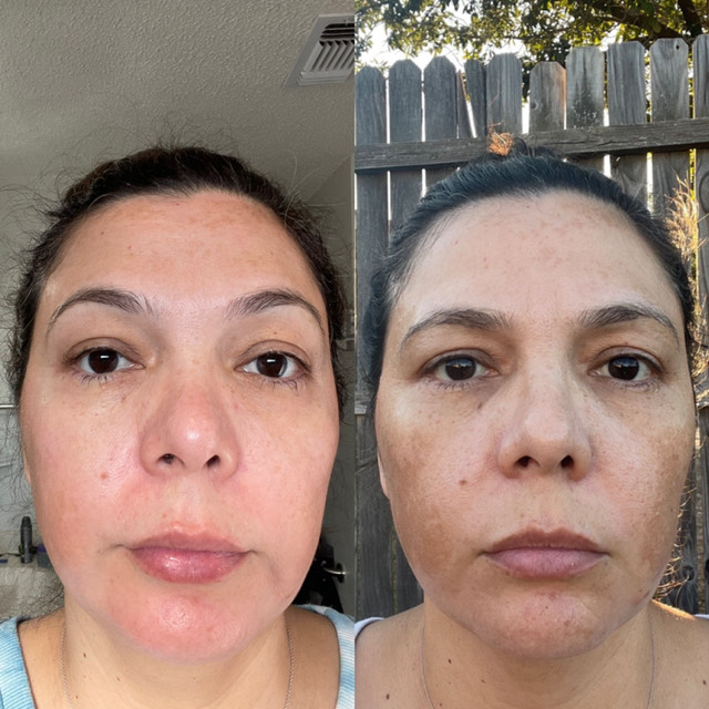 Musely FaceRx: Prescription Skincare Beauty Products