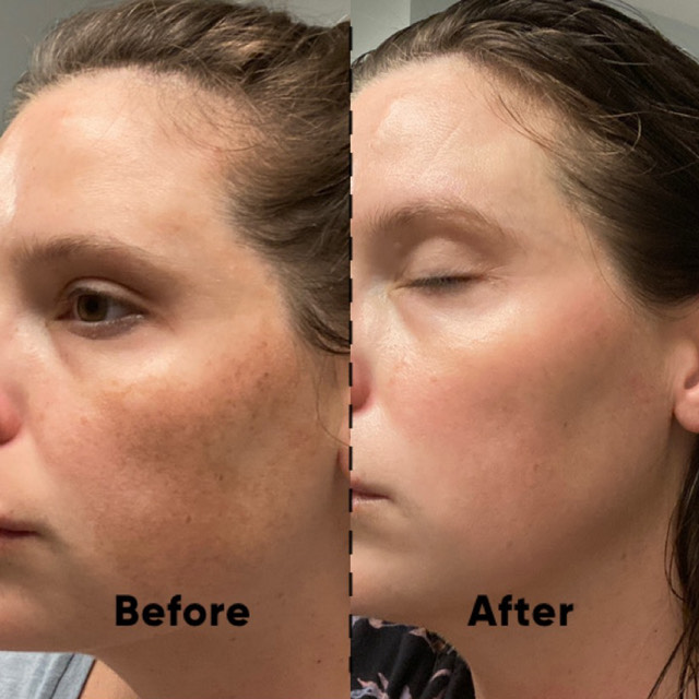 Musely FaceRx: Prescription Skincare Beauty Products