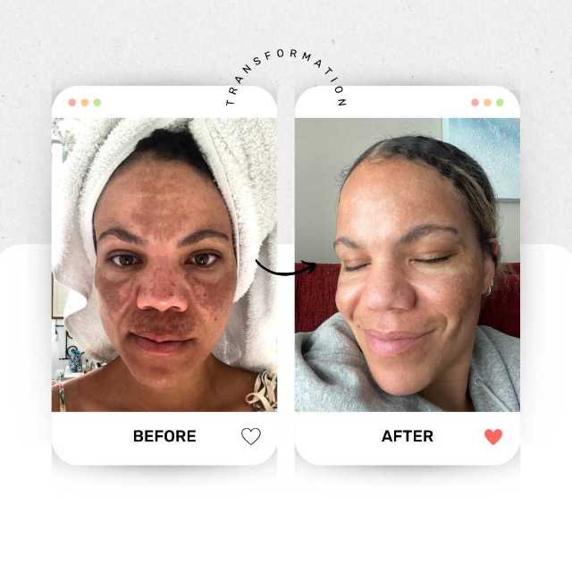 Musely Prescription Skin Care Products | Dark Spots, Aging, Rosacea ...