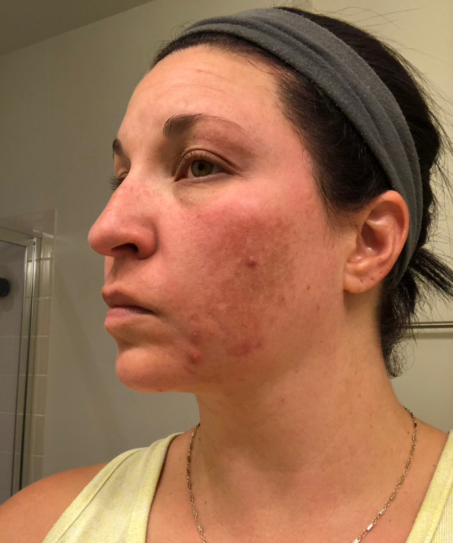 Real Life-Changing Results With Musely FaceRx | #MuselyWorks