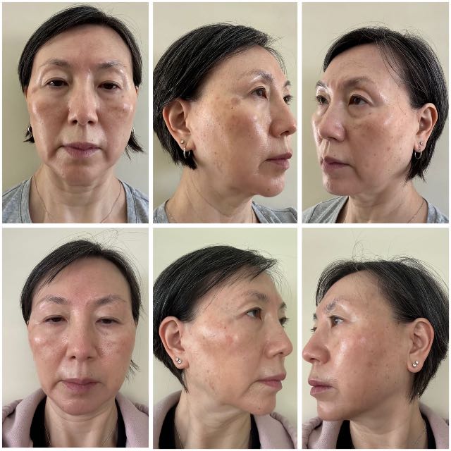 Rosacea Treatments | Skin Treatments For Redness | Musely