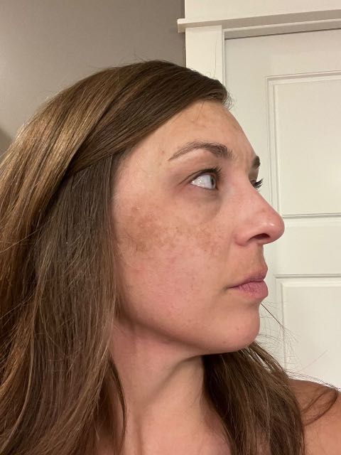 Musely Prescription Skin Care Products | Dark Spots, Aging, Rosacea ...