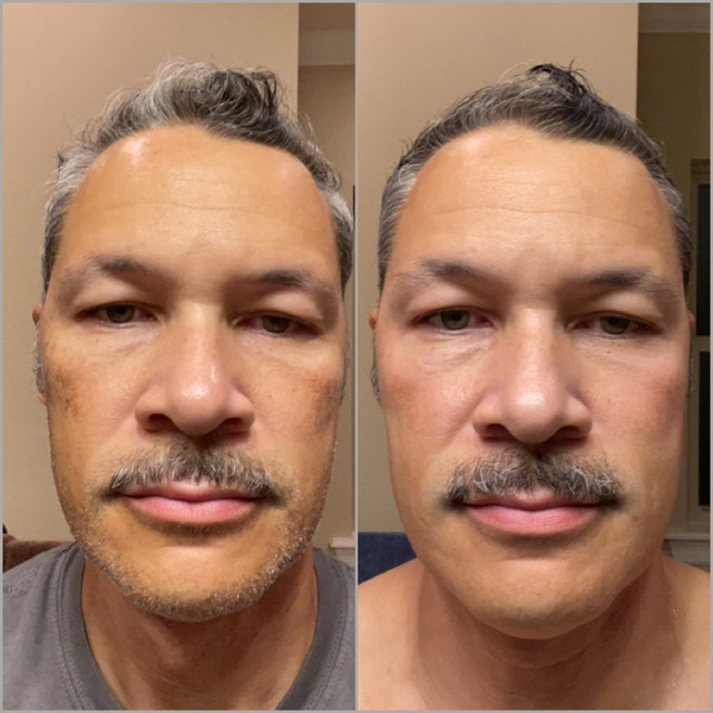 Musely FaceRx: Prescription Skincare Beauty Products