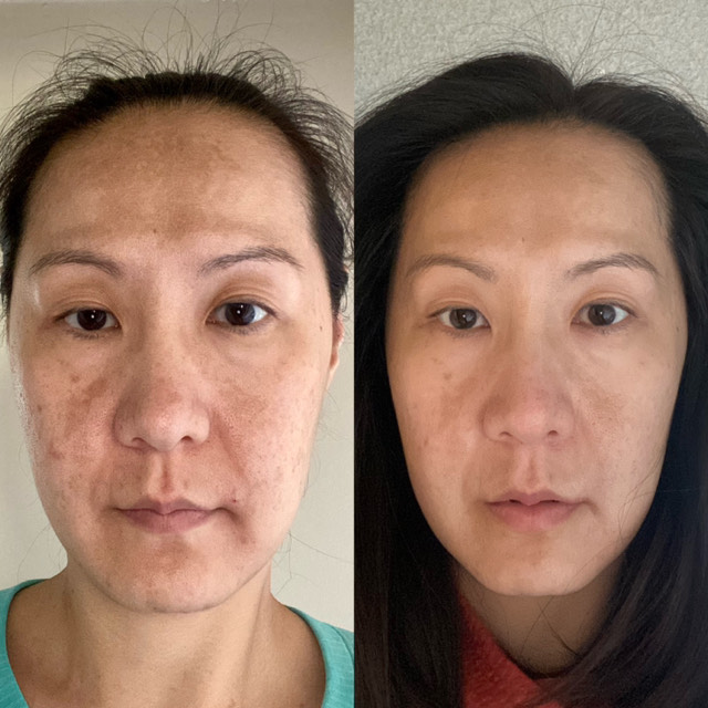 Musely FaceRx: Prescription Skincare Beauty Products