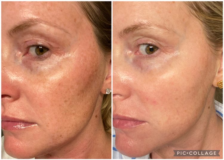 Musely FaceRx: Prescription Skincare Beauty Products