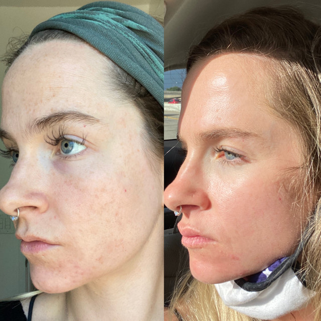 Real Life-Changing Results With Musely FaceRx | #MuselyWorks