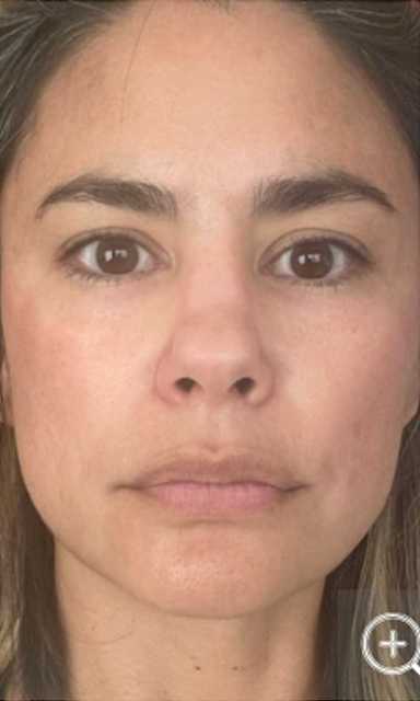 Body Skin Treatments | Body Cream | Neck Cream | Musely