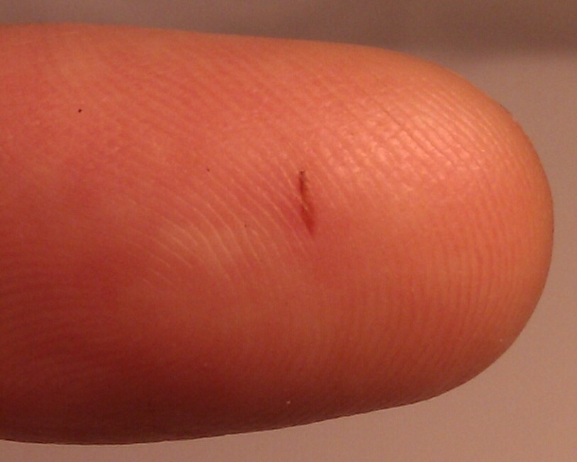 How To Painlessly Remove A Splinter Musely How To Painlessly Remove A Splinter Musely
