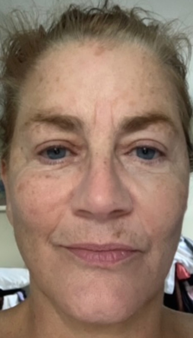 Musely FaceRx: Prescription Skincare Beauty Products