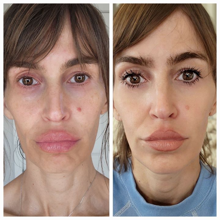 Real Results And Testimonials | Musely FaceRx Community