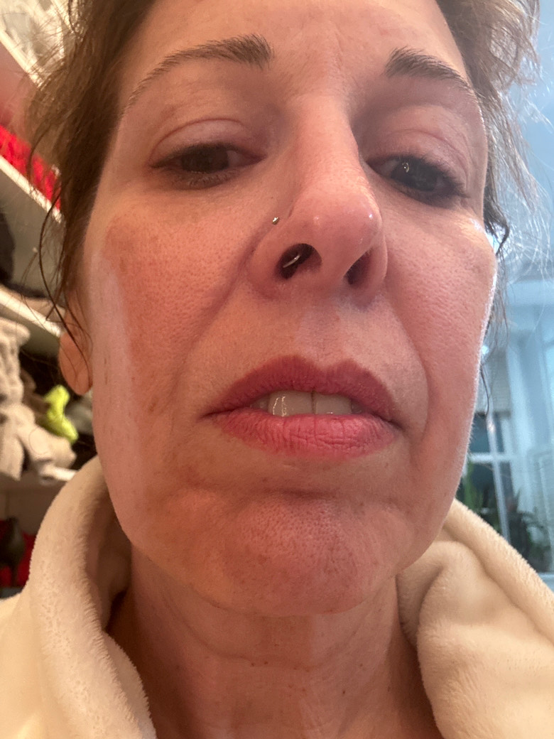 Facial Hair Eflornithine Cream Reviews - Remove Unwanted Facial Hair