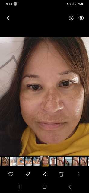 Musely Prescription Skin Care Products | Dark Spots, Aging, Rosacea ...