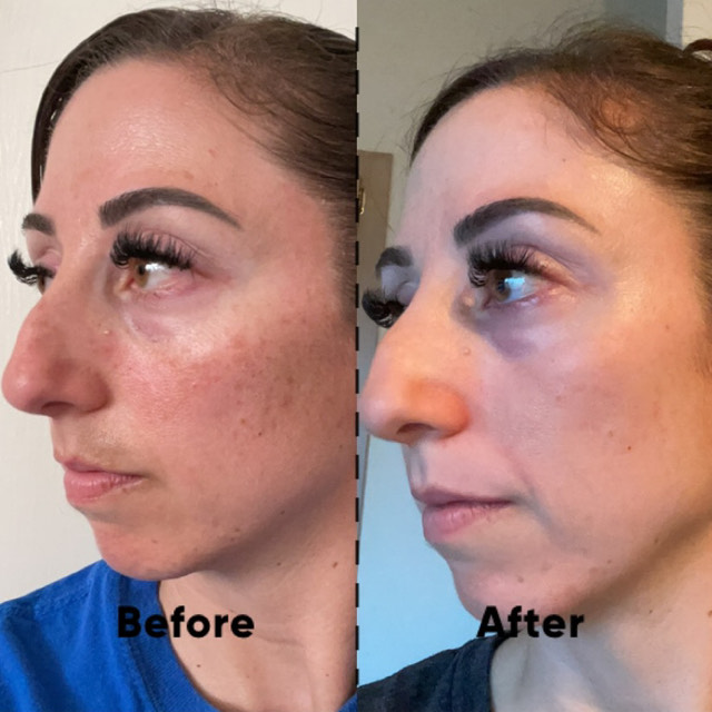 Real Life-Changing Results With Musely FaceRx | #MuselyWorks