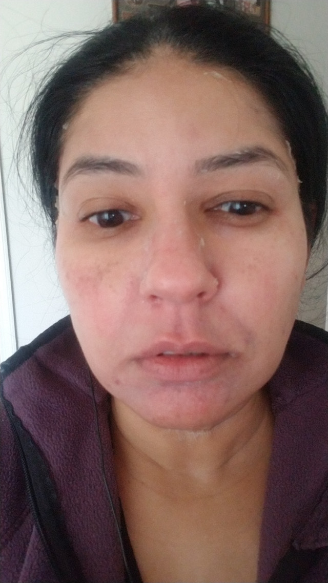 Musely FaceRx: Prescription Skincare Beauty Products