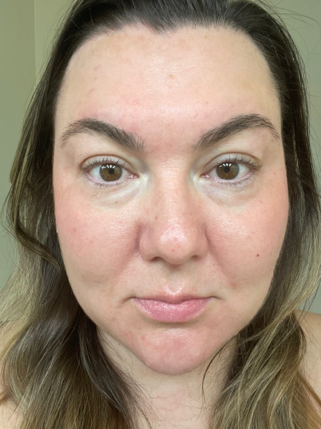 Real Results And Testimonials | Musely FaceRx Community