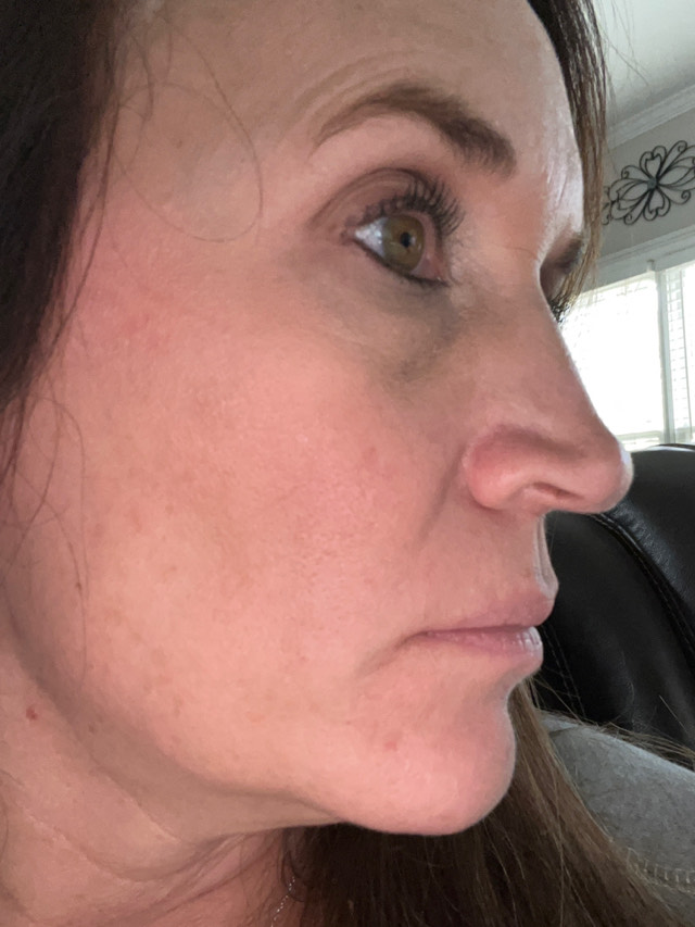 Musely FaceRx: Prescription Skincare Beauty Products