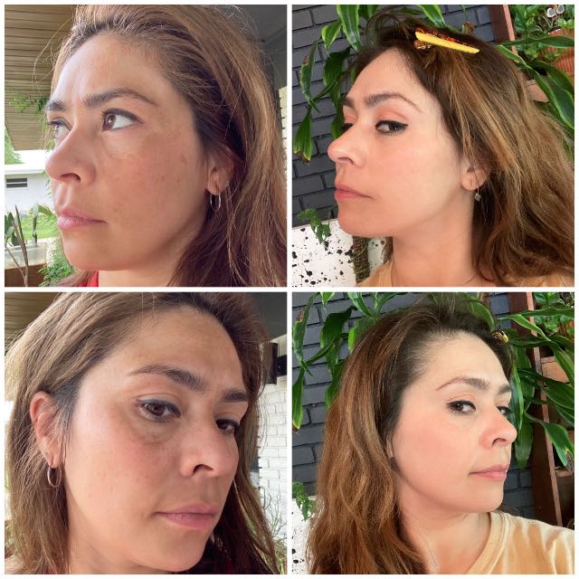 Musely Prescription Skin Care Products | Dark Spots, Aging, Rosacea ...