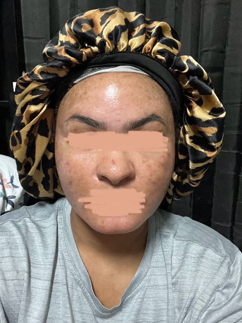 Body Skin Treatments | Body Cream | Neck Cream | Musely