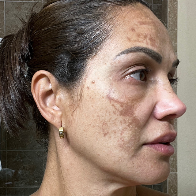 Real Results And Testimonials | Musely FaceRx Community