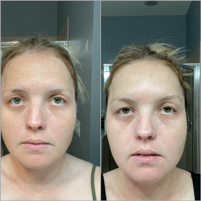 Musely FaceRx: Prescription Skincare Beauty Products