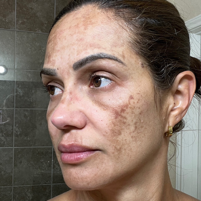 Real Results And Testimonials | Musely FaceRx Community