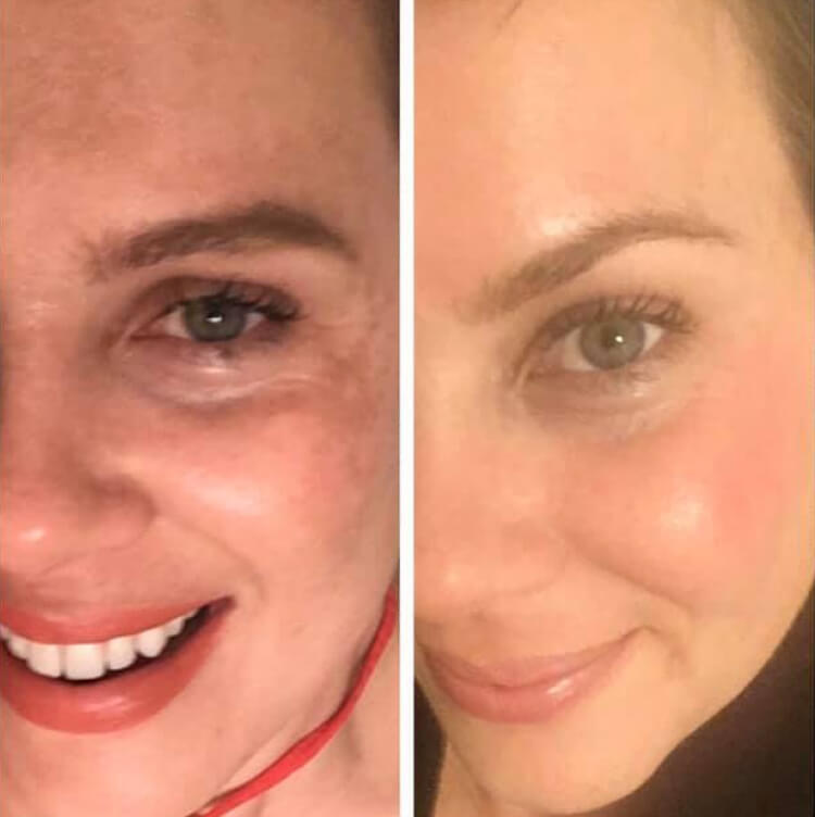 Get Clear and Youthful Skin | Maintain Results Musely Upkeep